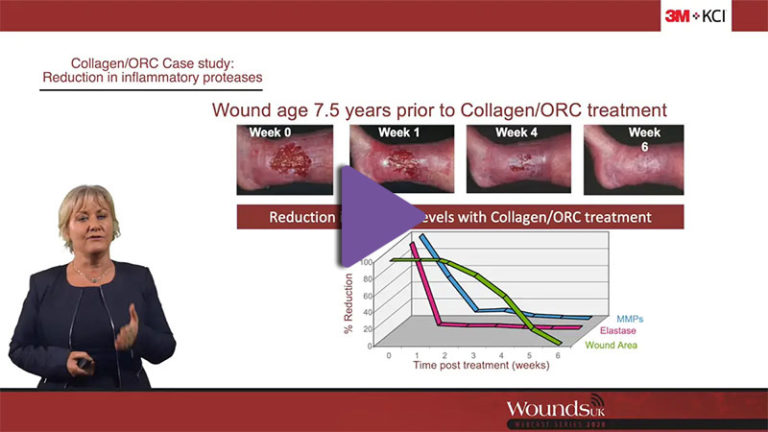 Infection vs Inflammation – 3M